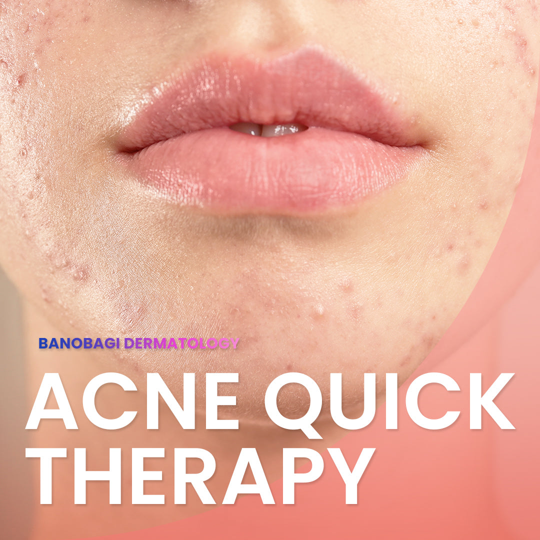 Acne Quick Therapy - Jivaka Beauty