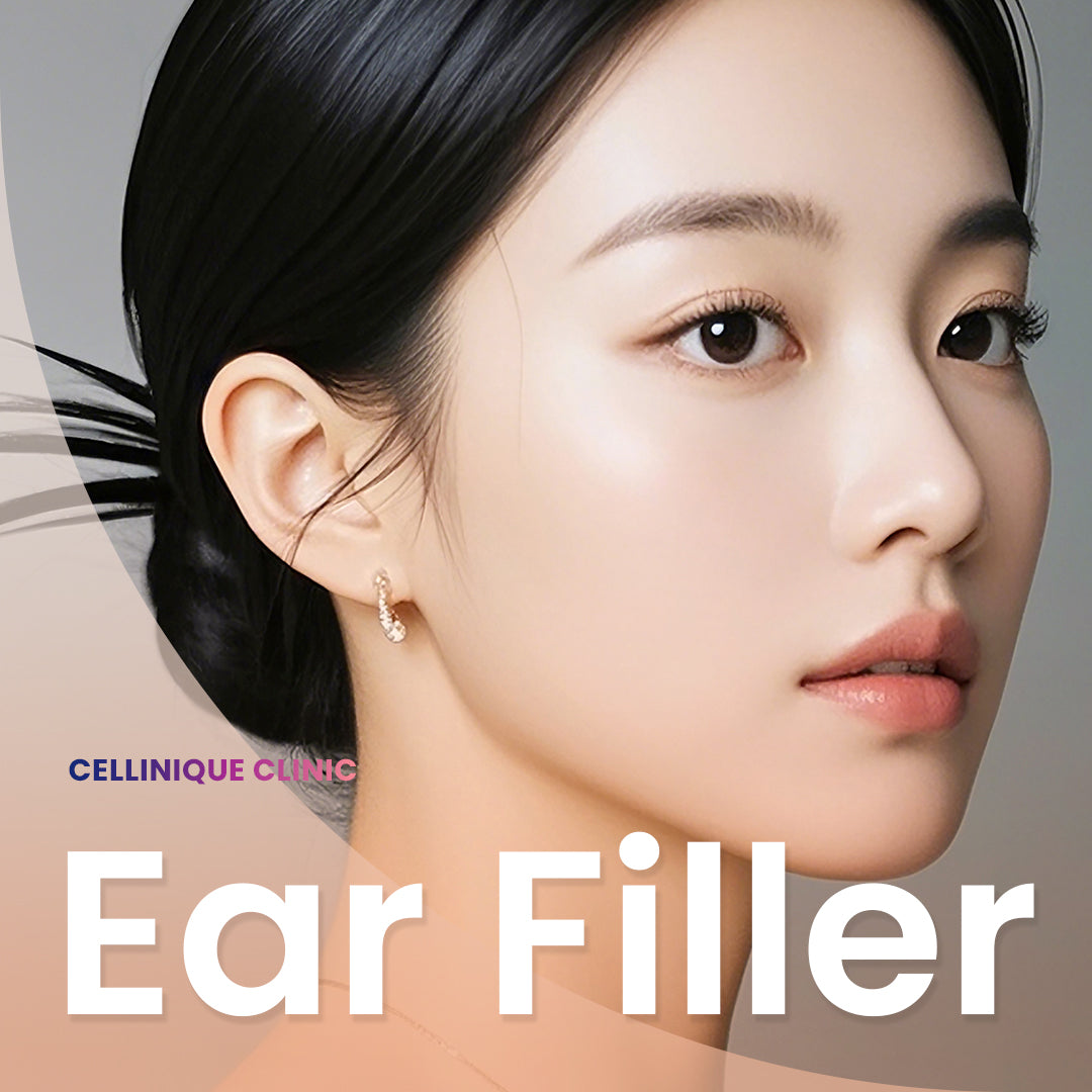 Ear Filler in Cheongdam, Korea - Jivaka Beauty